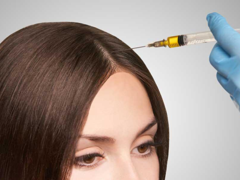 PRP Treatment for Hair in Sharjah | Plasma Hair Treatment in Sharjah ...
