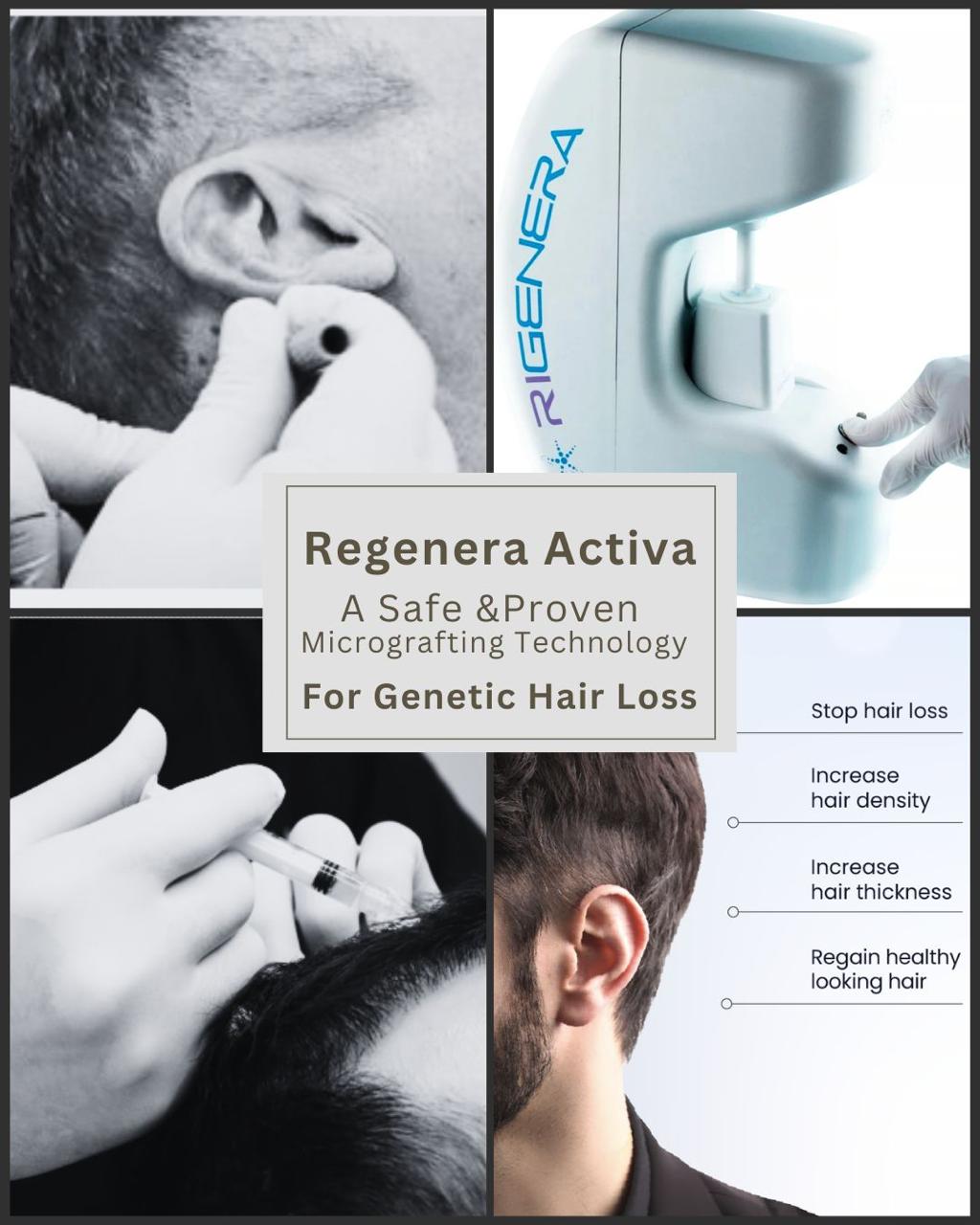 Regenera Hair Treatment in Sharjah | Hair Loss Treatment in Sharjah